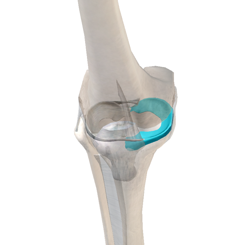 Lésions méniscales - PRO-TMS