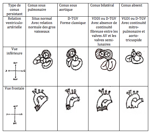 Analyse segmentaire - Imagerie des malformations cardiaques