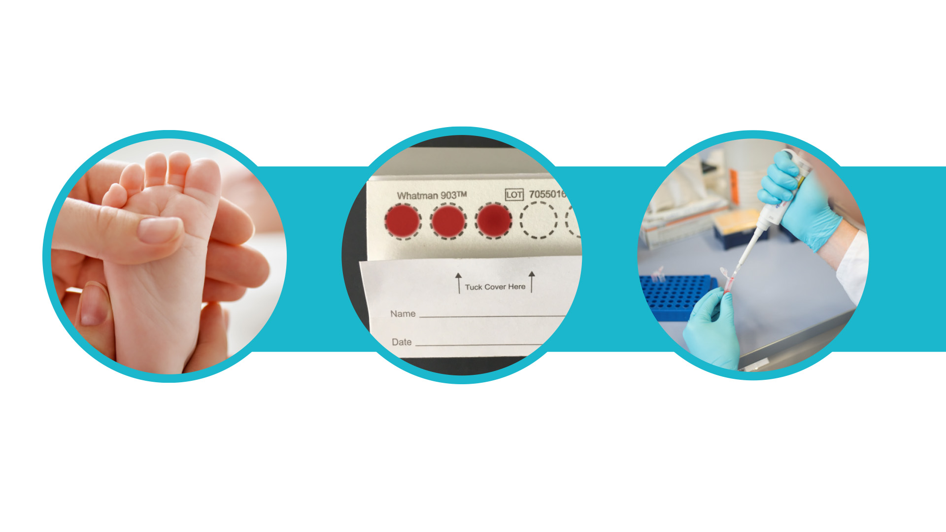 Neue Forschungsstudie zeigt: Epimune-Test reduziert die Anzahl ...