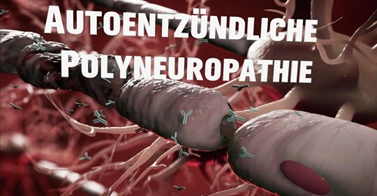Polyneuritis - Polyneuroradikulitis - Polyneuropathie Selbsthilfeforum