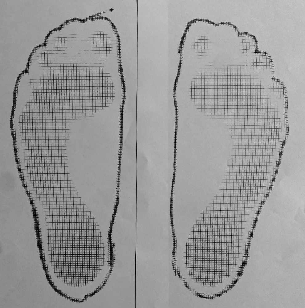 foot engineer (フットエンジニア) - 出張オーダーメイドインソール作製×理学療法士