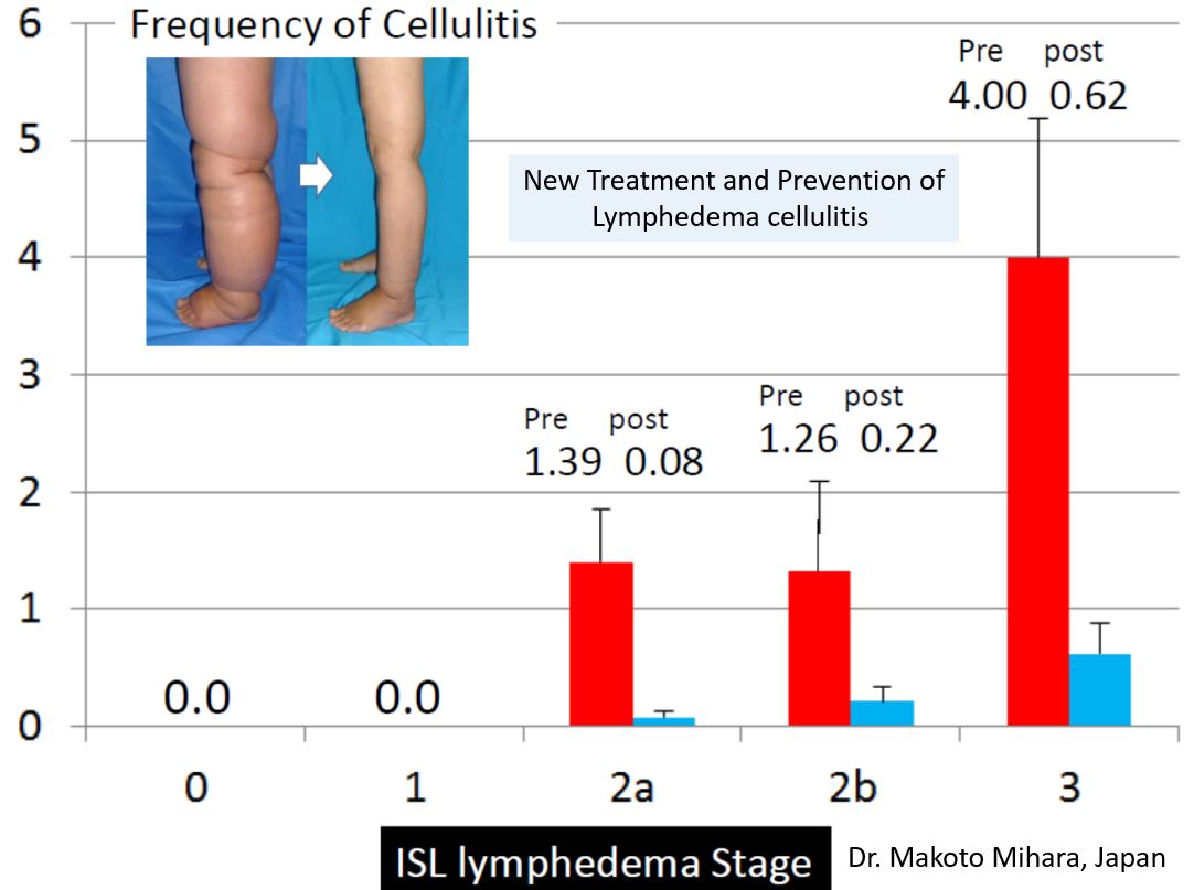 Cases, Cellulitis, Pain - Mominoki Day Surgery Clinic in Japan