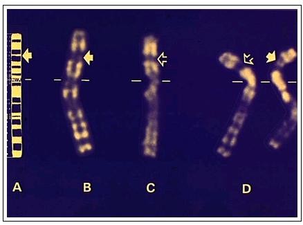cours svt 3ème chromosomes et information héréditaire PDF Cours ...
