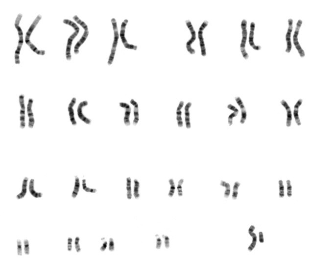 Chromosomes et information héréditaire - Site de cours de collège et ...