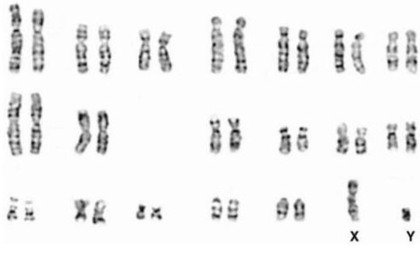 Chromosomes et information héréditaire - Site de cours de collège et ...