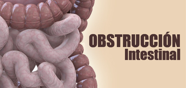 OBSTRUCCION INTESTINAL - Nasajpg.com