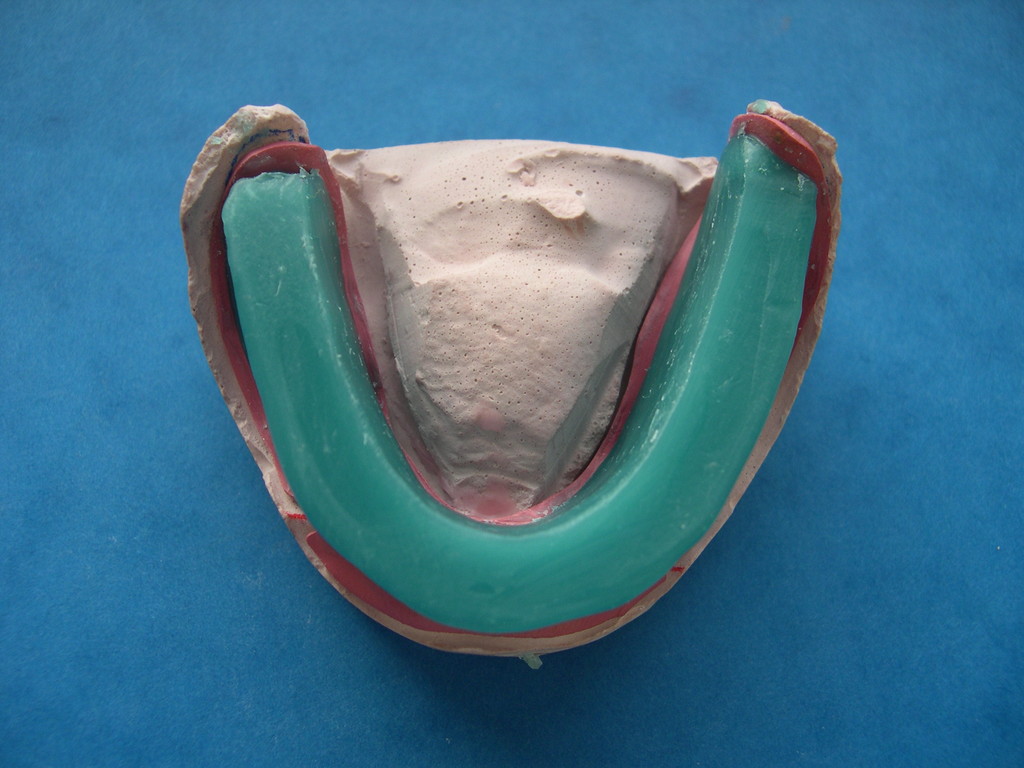 Confección de rodillo de articulación superior - Apuntes de prótesis dental