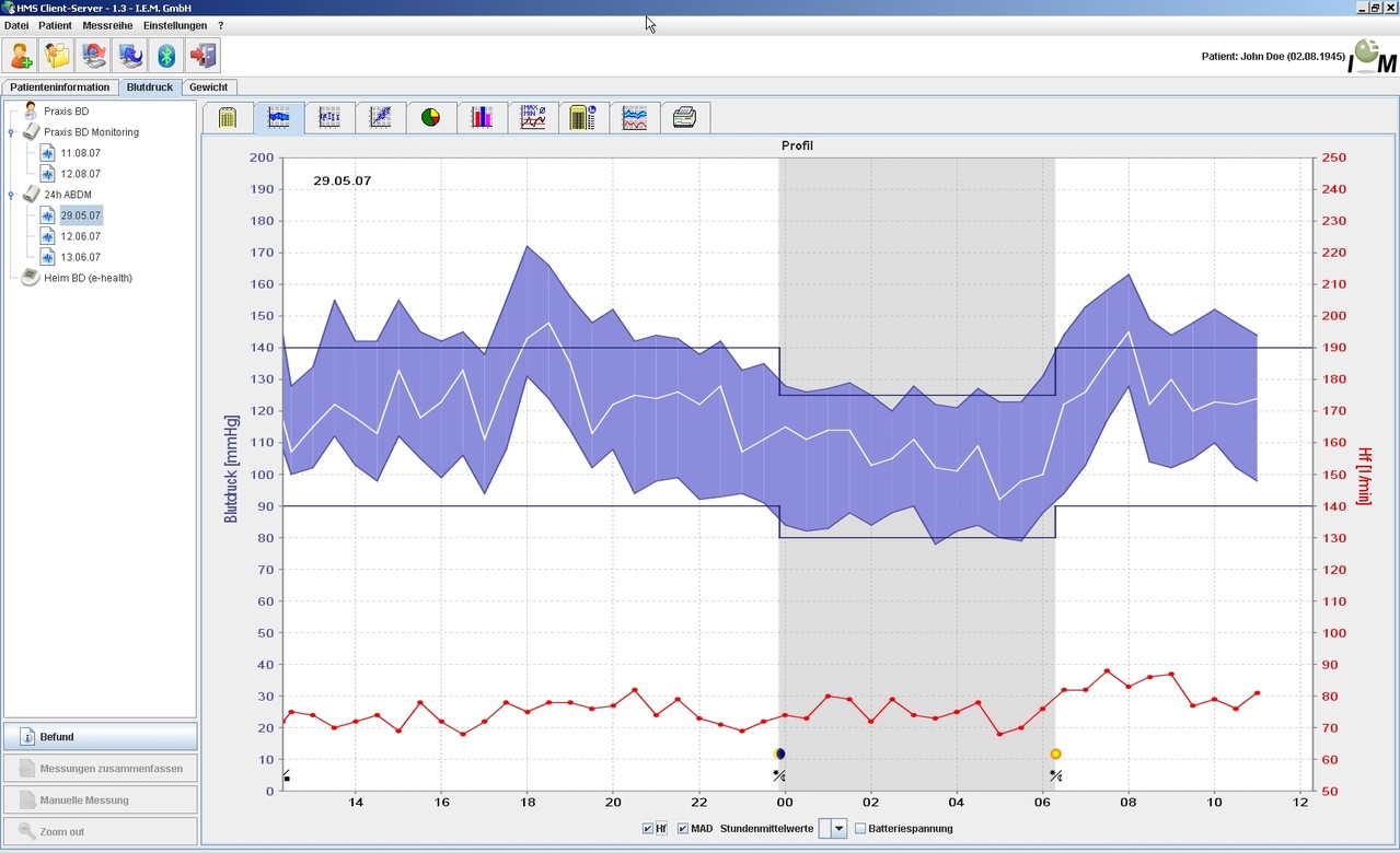 Mobil-O-Graph® NG - STRUCK Medizintechnik GmbH Medical Concept