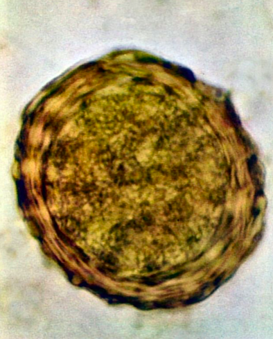 Ascaris spp. - Site de parasitoprimates