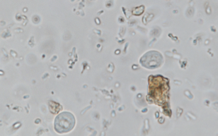 Chilomastix mesnili - Site de parasitoprimates