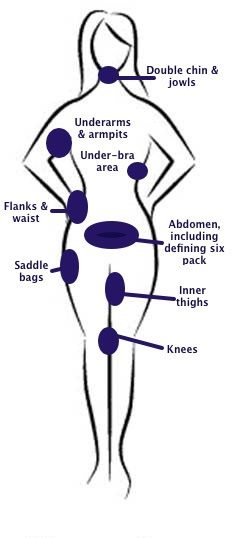 Swansea fat dissolving injections - Skin Clinic