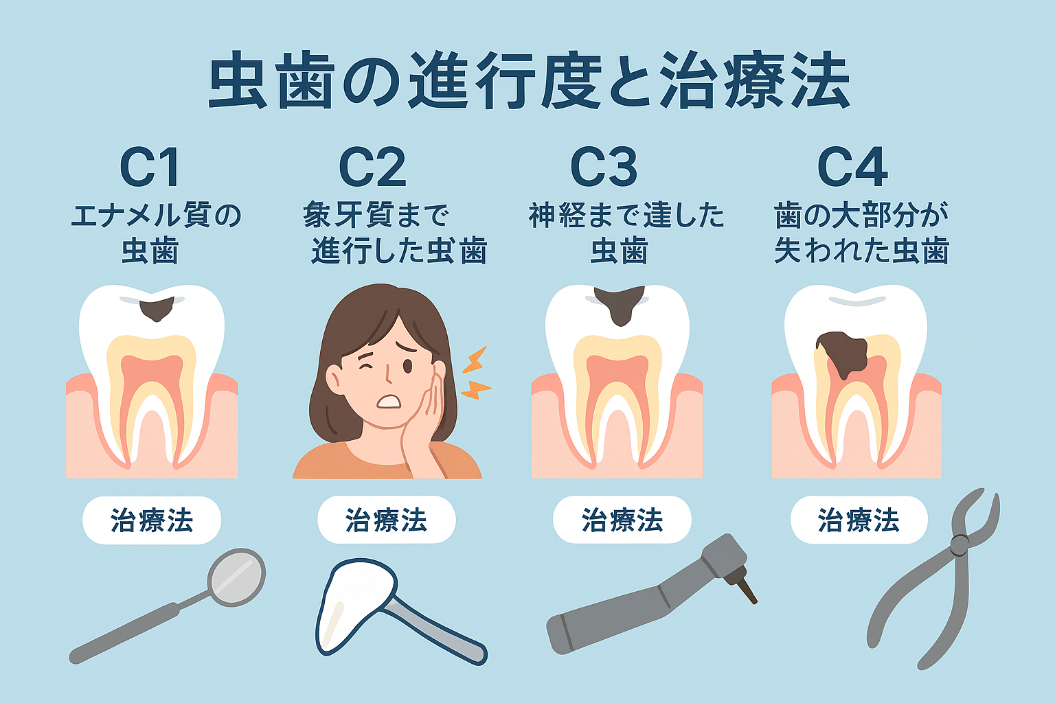 虫歯の進行度と治療法｜C1〜C4の違いを解説 - 京都市の歯医者｜ますみデンタルクリニック