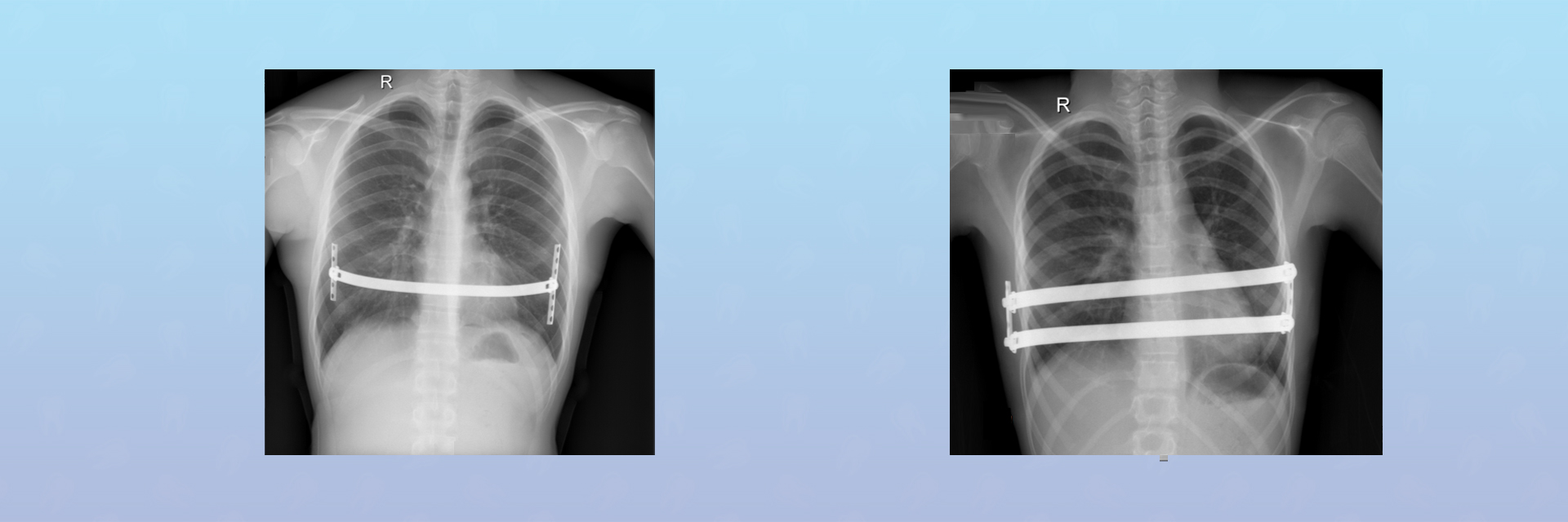 Finding the Best Thoracic Surgeon Doctors in Delhi for Optimal Chest ...
