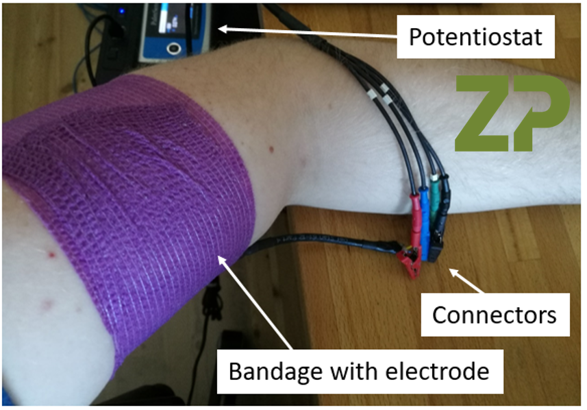 Wearable Skin Sensors and understanding the Signal - zimmerandpeacock