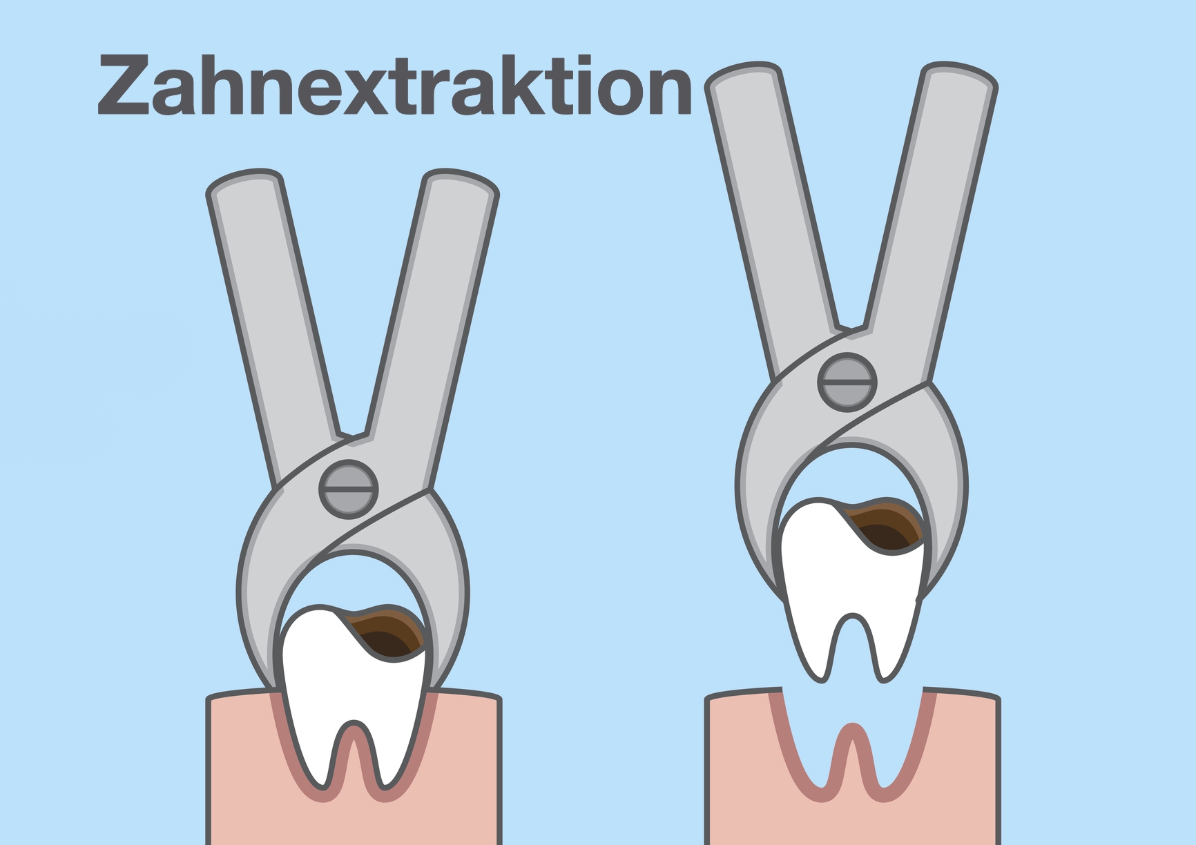 Zahnbehandlung - Zahnarztpraxis Dr. Ulrich Kiefer
