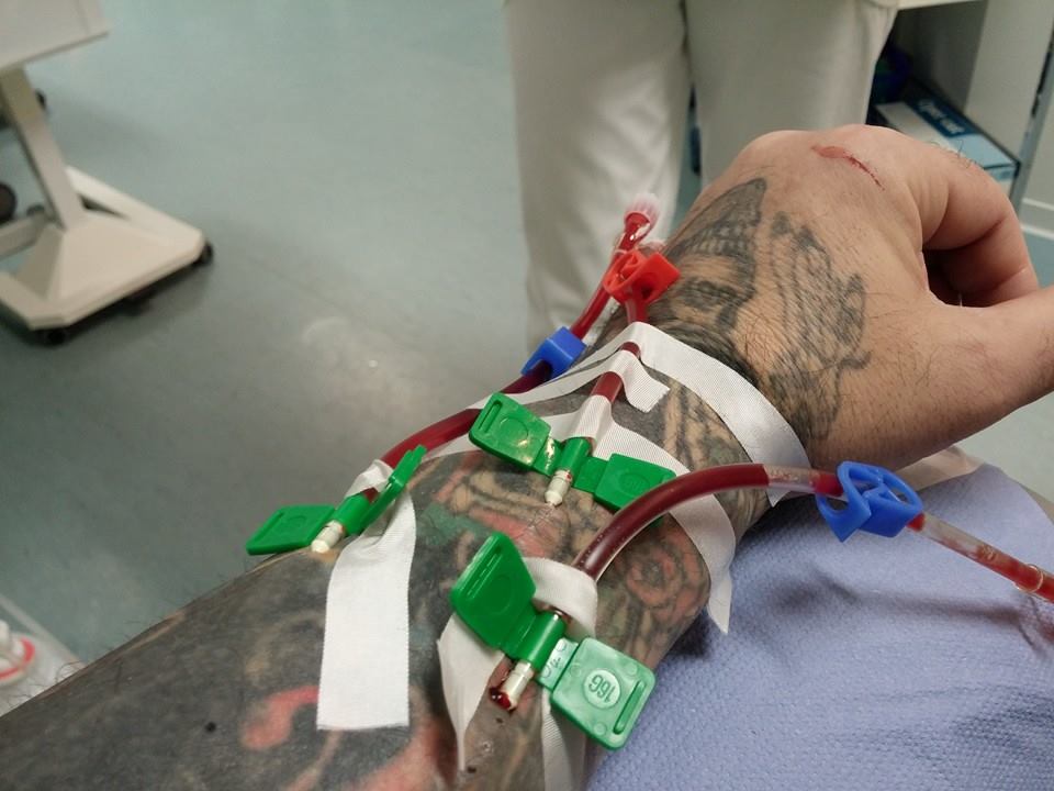 Prof. Dr. med. Brittinger "Zur Dialyseshuntchirurgie gehört Demut und ...