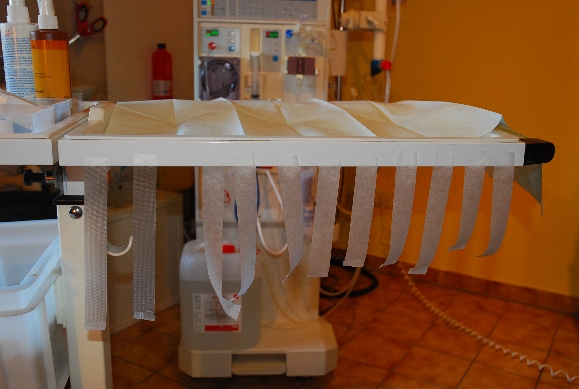 Punktion eines PTFE Shunts - Spektrum Dialyse – Wissen, Hilfe & Infos ...