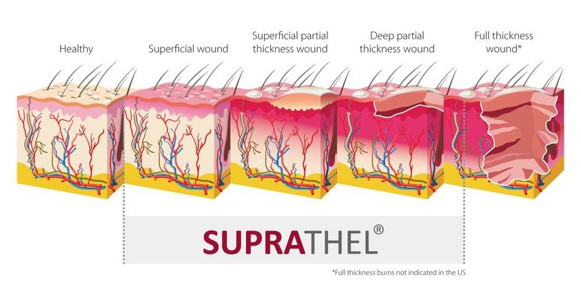Training suprathel - Avaneo