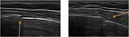Ultraschall des Bewegungsapparates - Berner Rheumazentrum am Viktoriaplatz