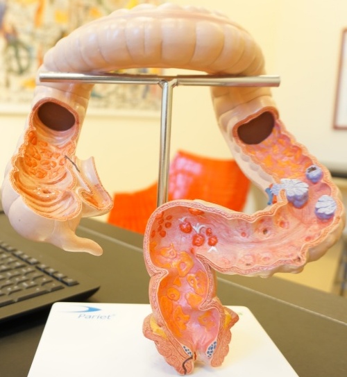 Enddarmspiegelung Hannover - coloskopium Darmspiegelung ...