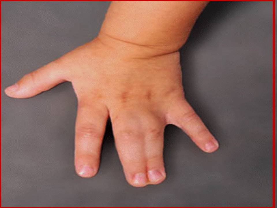 -La sindrome di Timothy - gennarino borrello