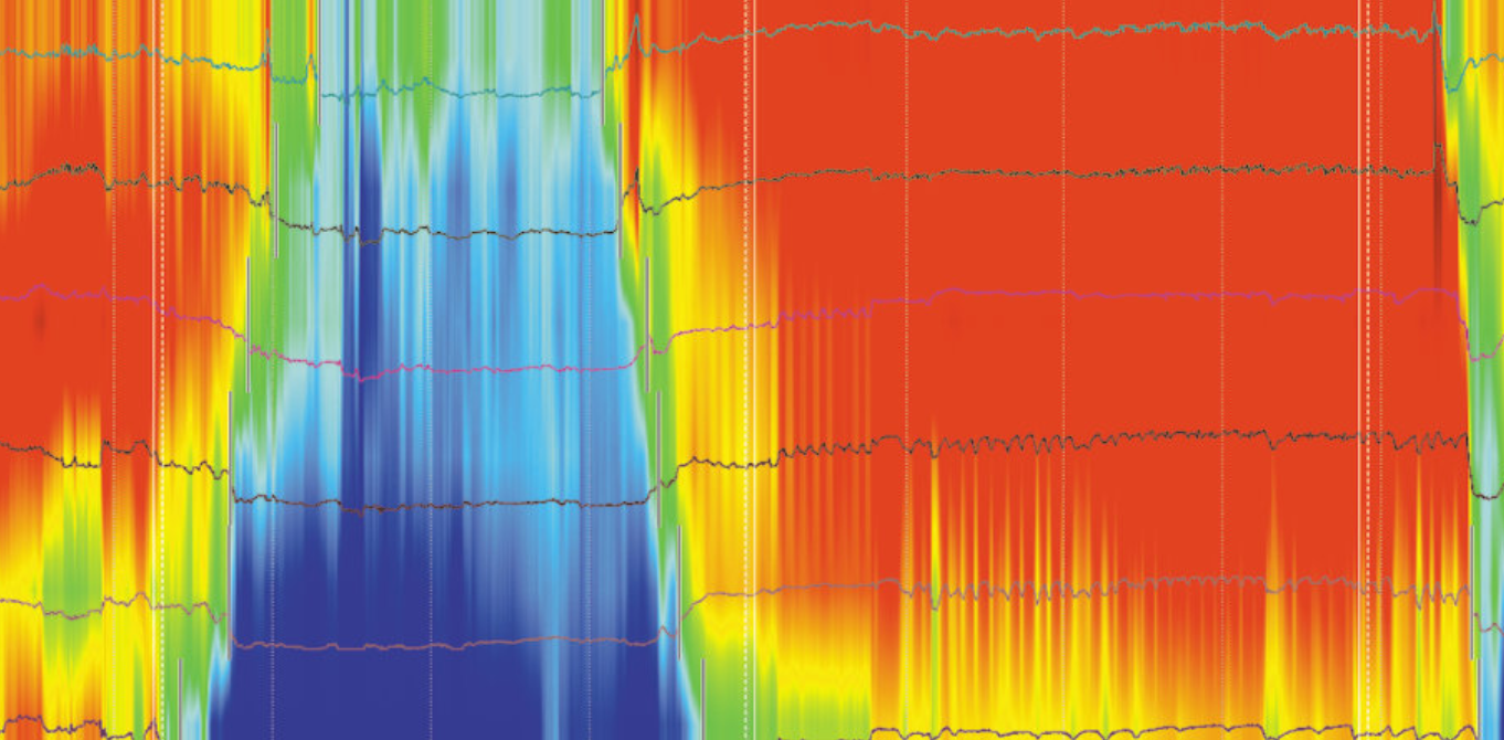 pH-Metrie - dr-kempelmanns Webseite!