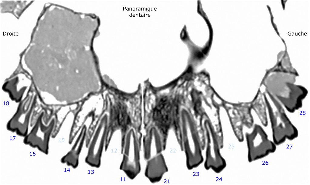 Aztec skull - Dr. Marc Ghysels, Scantix