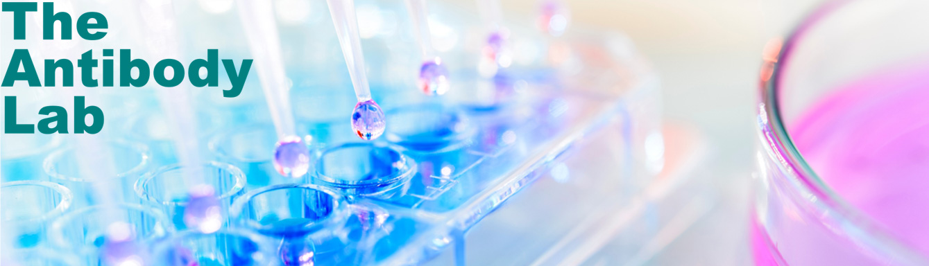 The Antibody Lab - The Antibody Lab