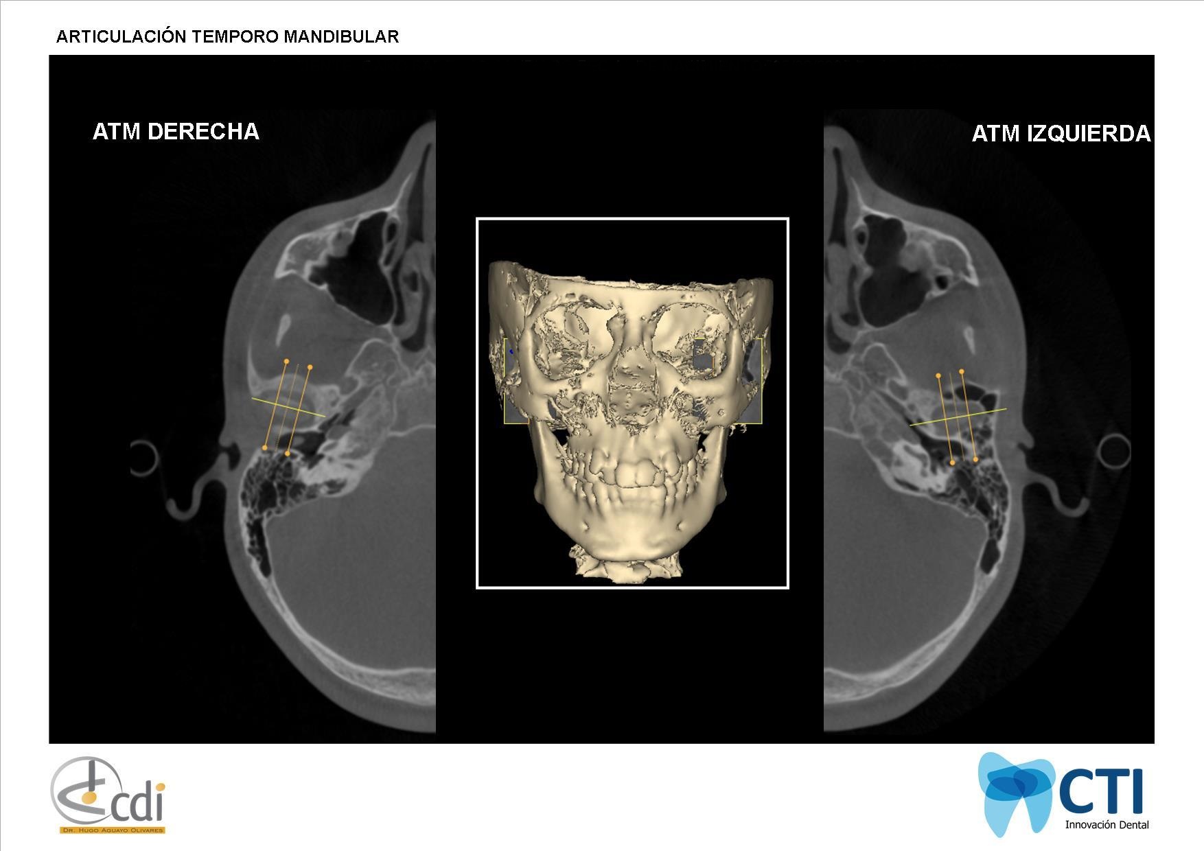 Evolucionando a la Cefalometría 3D - CDI