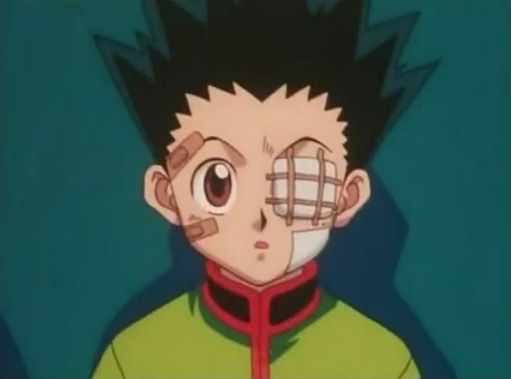 Gon (Ep. 36) - kuroitsubasa4