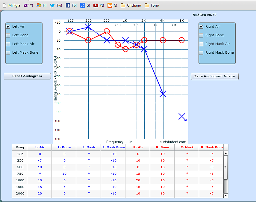 Creador de audiogramas ONLINE - *Mi Fonoaudiología~