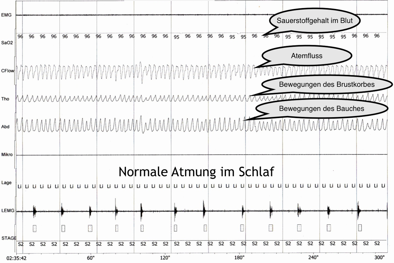 Polygraphie - Praxis Dr. Wylicil - Innere Medizin, Pneumologie
