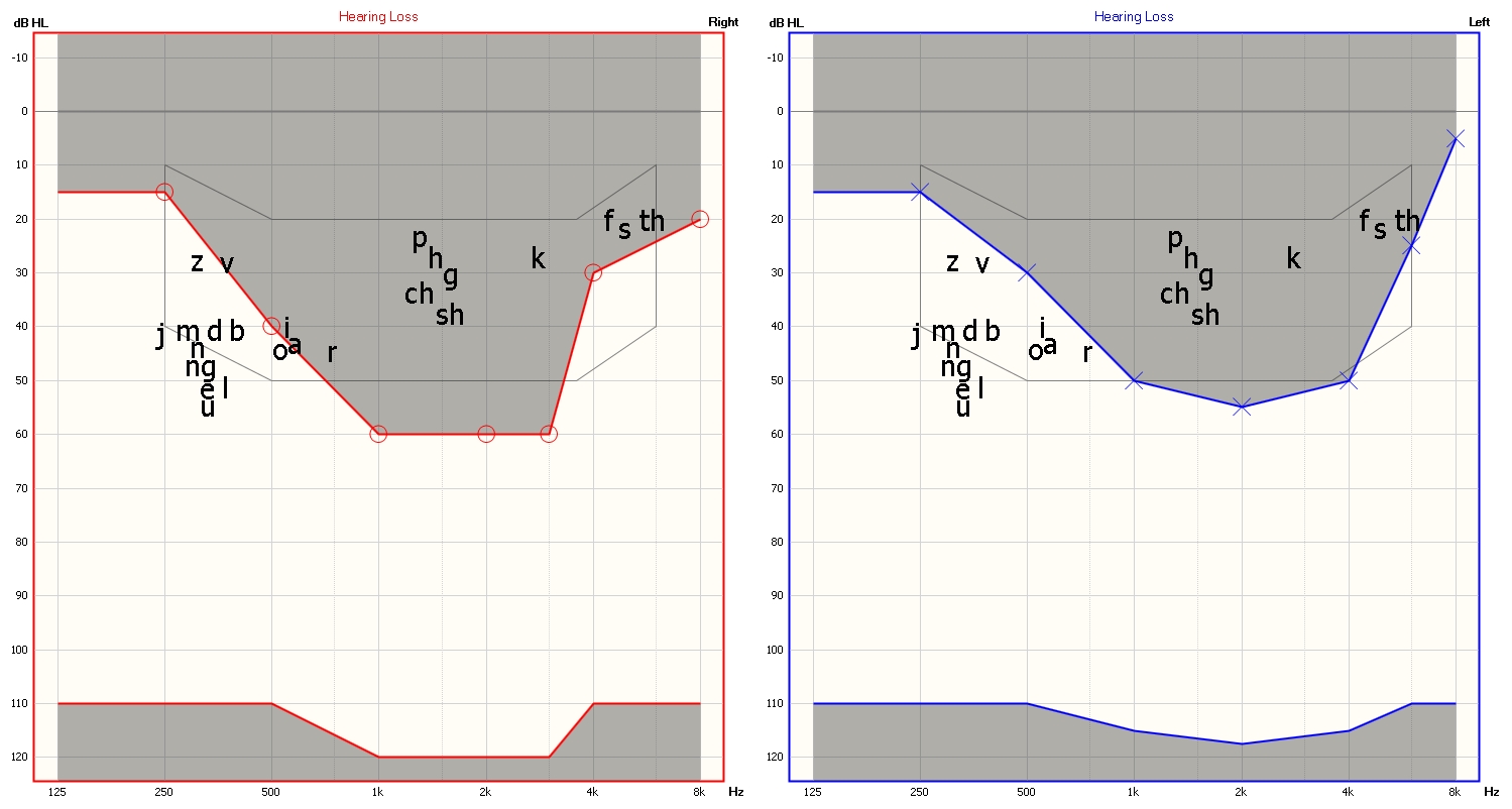 Visual Speech Mapping - De website van Kooijman Hoortoestellen!