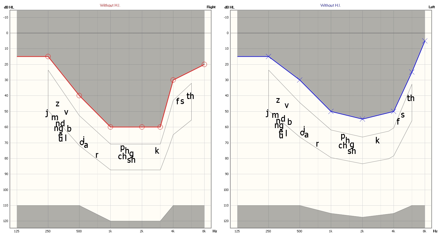 Visual Speech Mapping - De website van Kooijman Hoortoestellen!