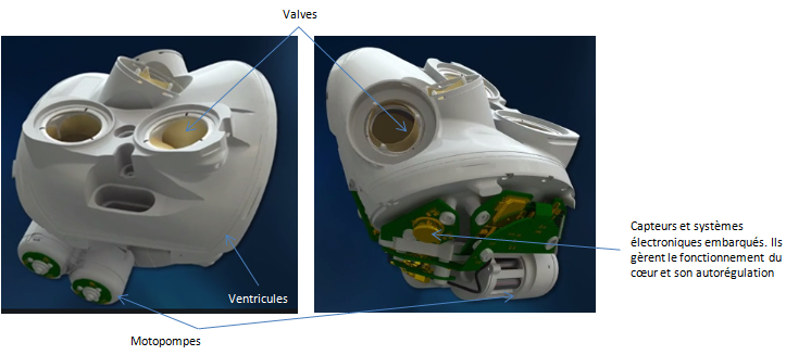 Le cœur artificiel – TPE sur le coeur artificiel