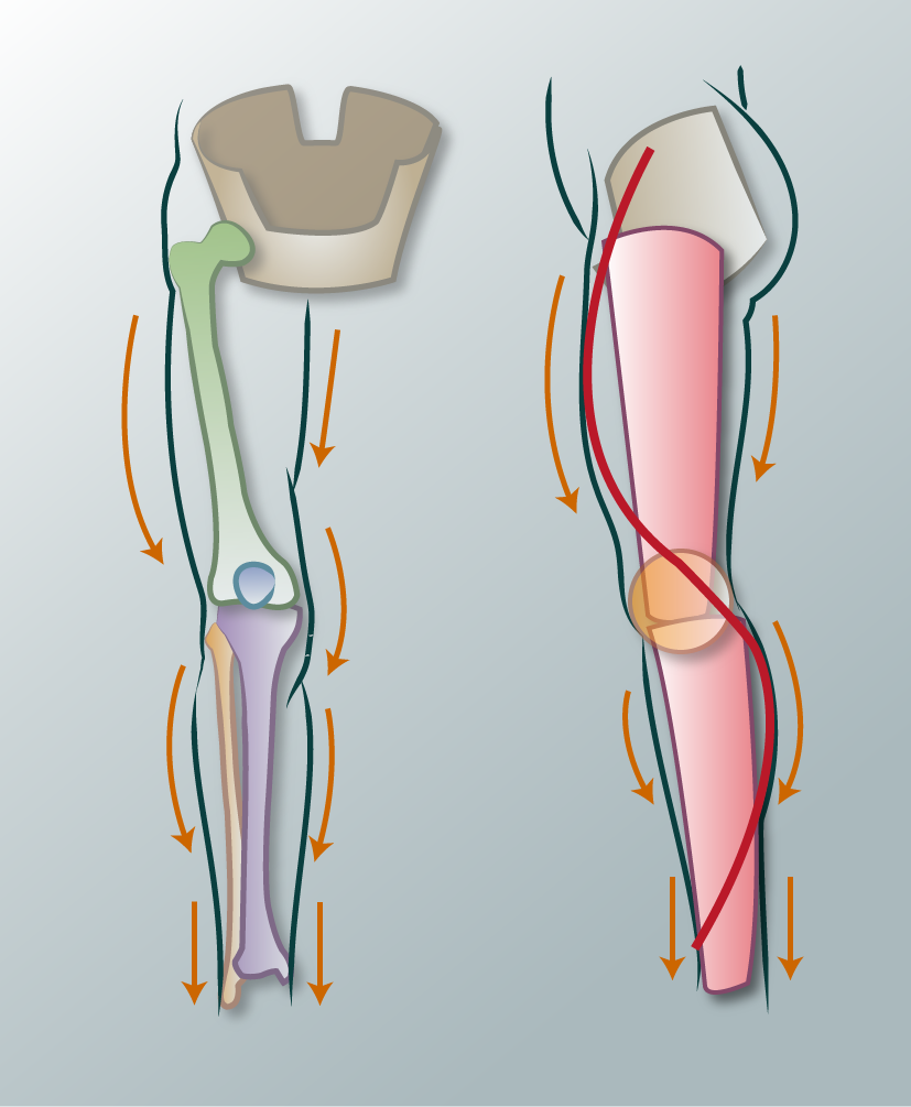 Extremidades inferiores - Guía Poly-Clay
