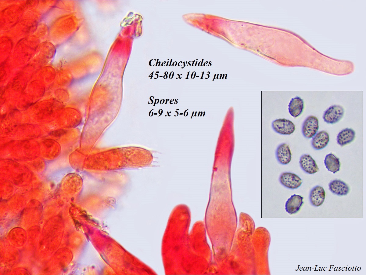 Microscopie et champignons - champignons en 3 clics