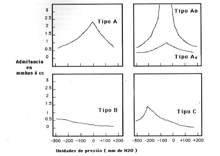 Timpanometría. Estudio de la compliancia o admitancia del tímpano ...