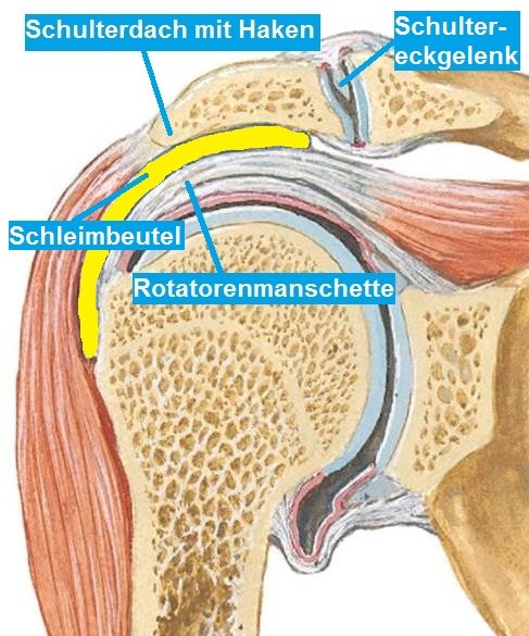 Enge unter dem Schulterdach: Engpass-Syndrom (Impingementsyndrom ...