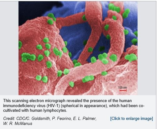 SE DESCUBRE LA CURA CONTRA EL VIRUS VIH-SIDA CON PLANTA TROPICAL ...
