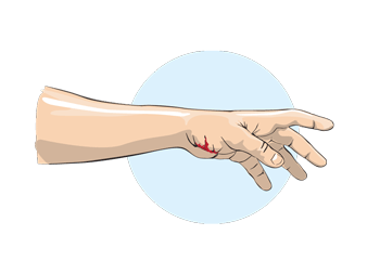 Hemorragias - AprendEmergencias