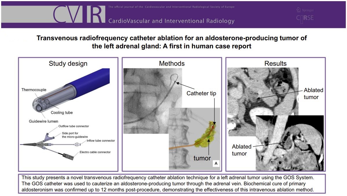 Visual abstracts library - CVIR - Official journal of CIRSE on ...