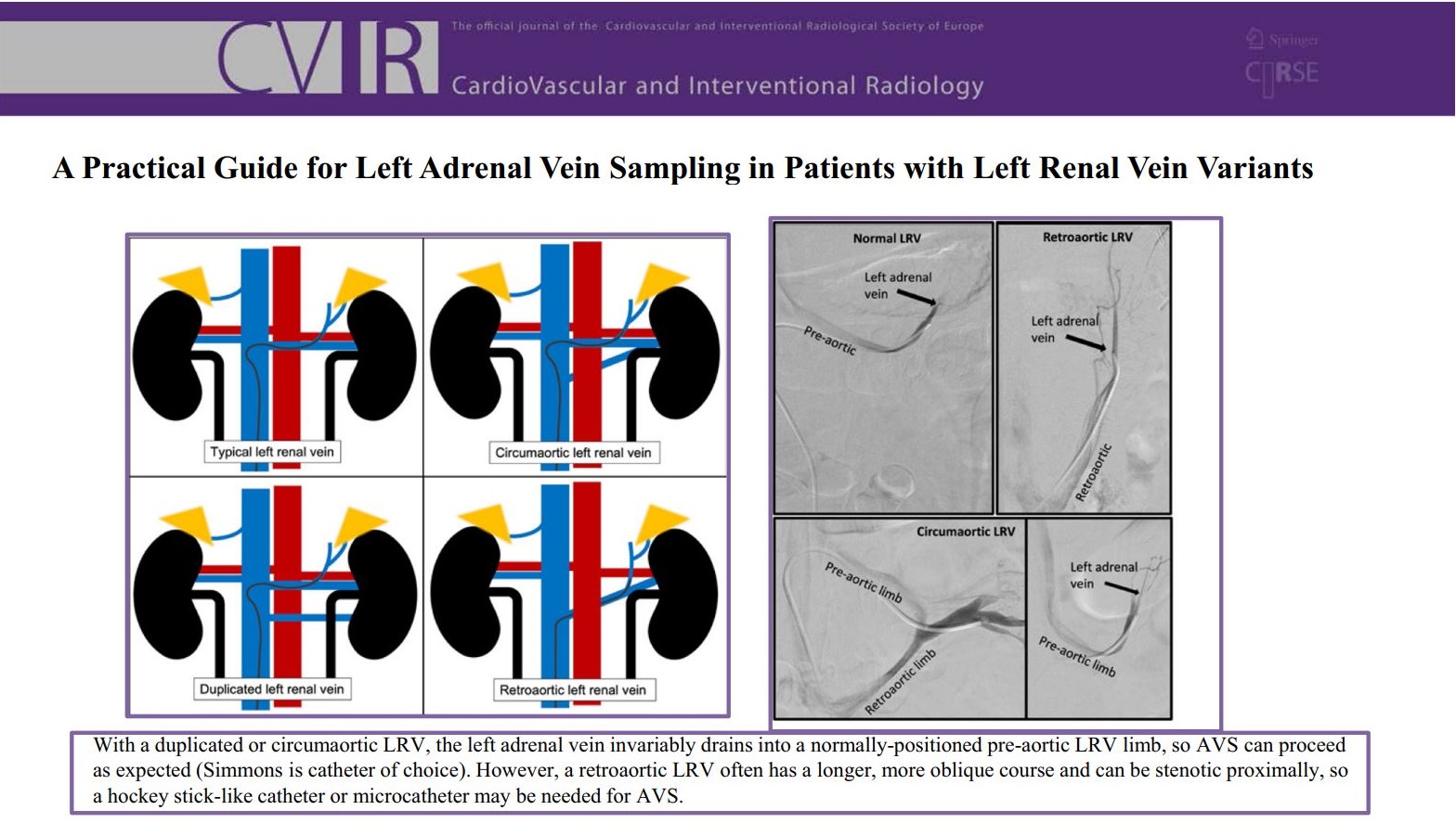 Visual abstracts library - CVIR - Official journal of CIRSE on ...