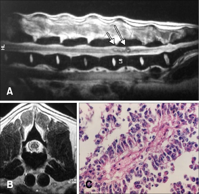 Imaging and surgical outcomes of spinal tumors in 18 dogs and one cat ...