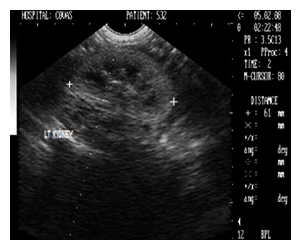 Ultrasonographic Imaging for Structural Characterization of Renal ...