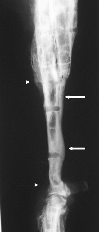 Osteosarcoma In Dogs Distal Radius