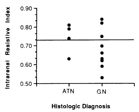 Duplex Doppler Estimation of Intrarenal Pourcelot Resistive Index in ...