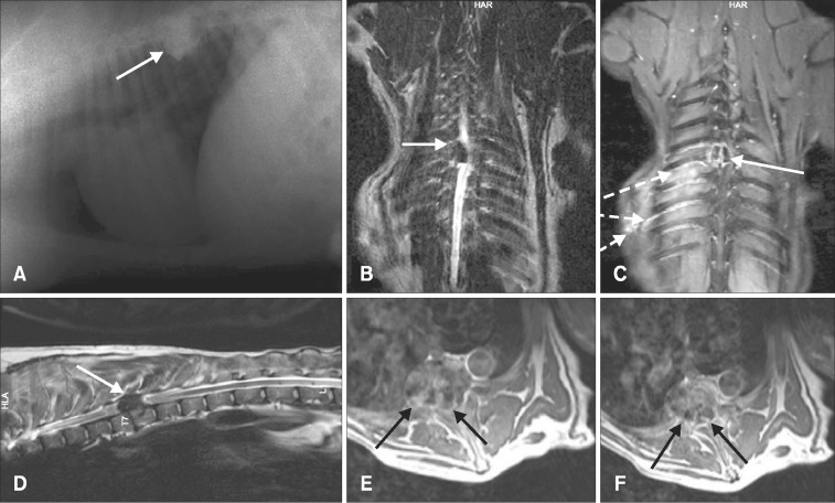 Imaging and surgical outcomes of spinal tumors in 18 dogs and one cat ...