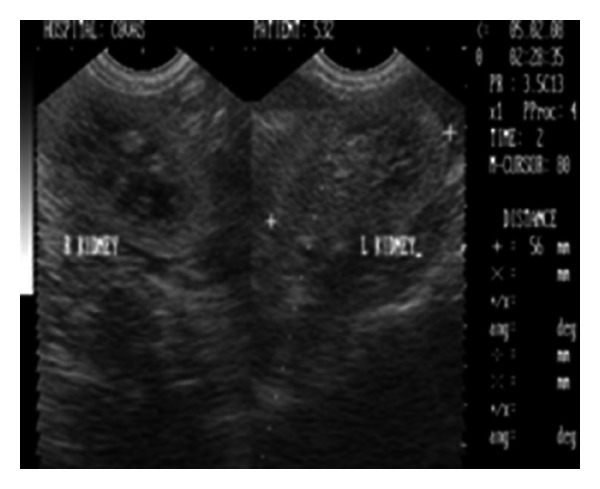 Ultrasonographic Imaging for Structural Characterization of Renal ...
