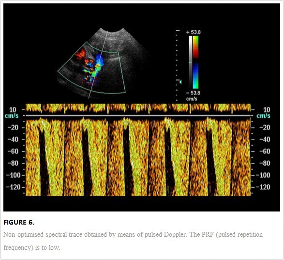 Foundamentals and Applications of Abdominal Doppler - Osteosarkom Hund ...
